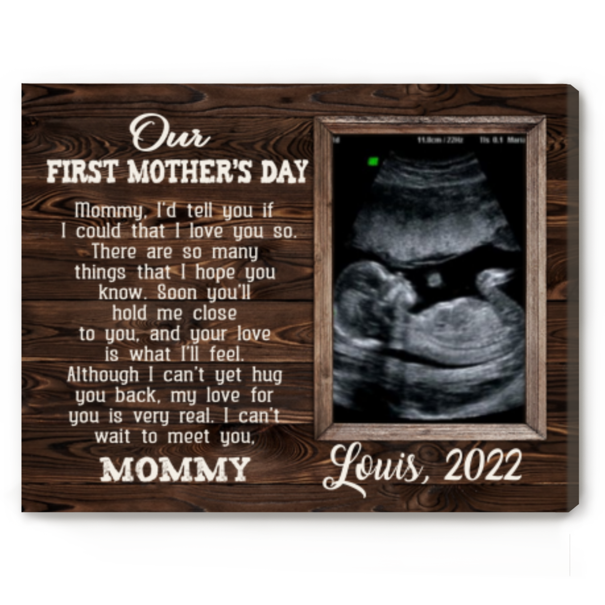 First Mothers Day Baby Sonogram Canvas, Mom To Be Custom Ultrasound ...